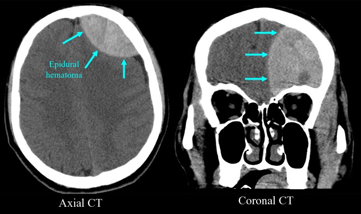RadiologySpirit: 2010-09-26