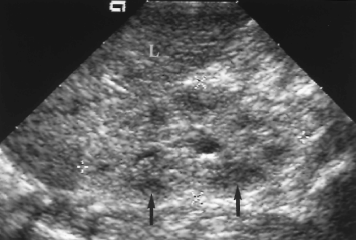 RadiologySpirit: 2010-10-10