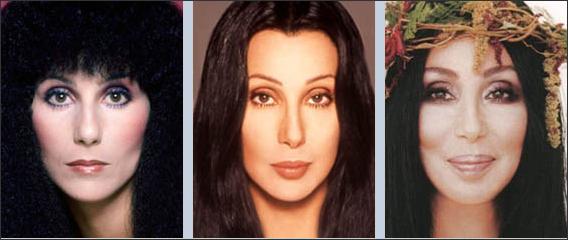 Cher Plastic Surgery