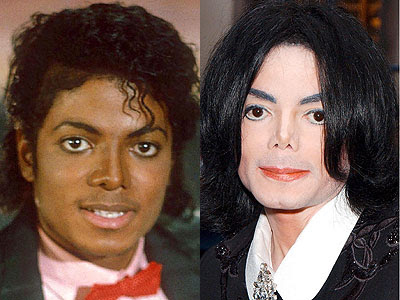 Michael Jackson Plastic Surgery
