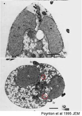 Skeptic Wonder: MM17 Answer - Spironucleus: double cells with twisted ...
