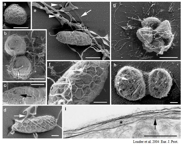 Skeptic Wonder: Sunday Protist - Labyrinthulomycota