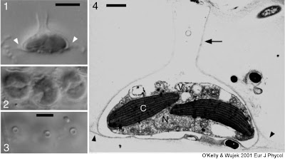 Skeptic Wonder: Sunday Protist - Lagynion: bottled algae