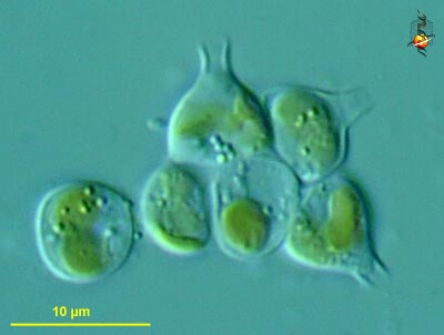 Skeptic Wonder: Sunday Protist - Lagynion: bottled algae