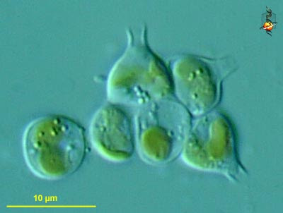 Skeptic Wonder: Sunday Protist - Lagynion: bottled algae