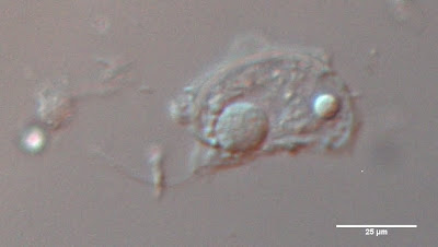 Skeptic Wonder: Termite gut microforay - excavate time!