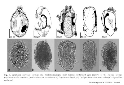 Skeptic Wonder: Sunday Protist - Litostomatea: rumen ciliates with ...