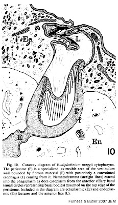 Skeptic Wonder: Sunday Protist - Litostomatea: rumen ciliates with ...