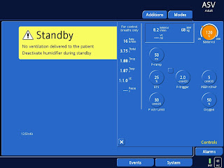FREMITUS: The "ASV Target Point": Adjusting the %MinVol setting During ...