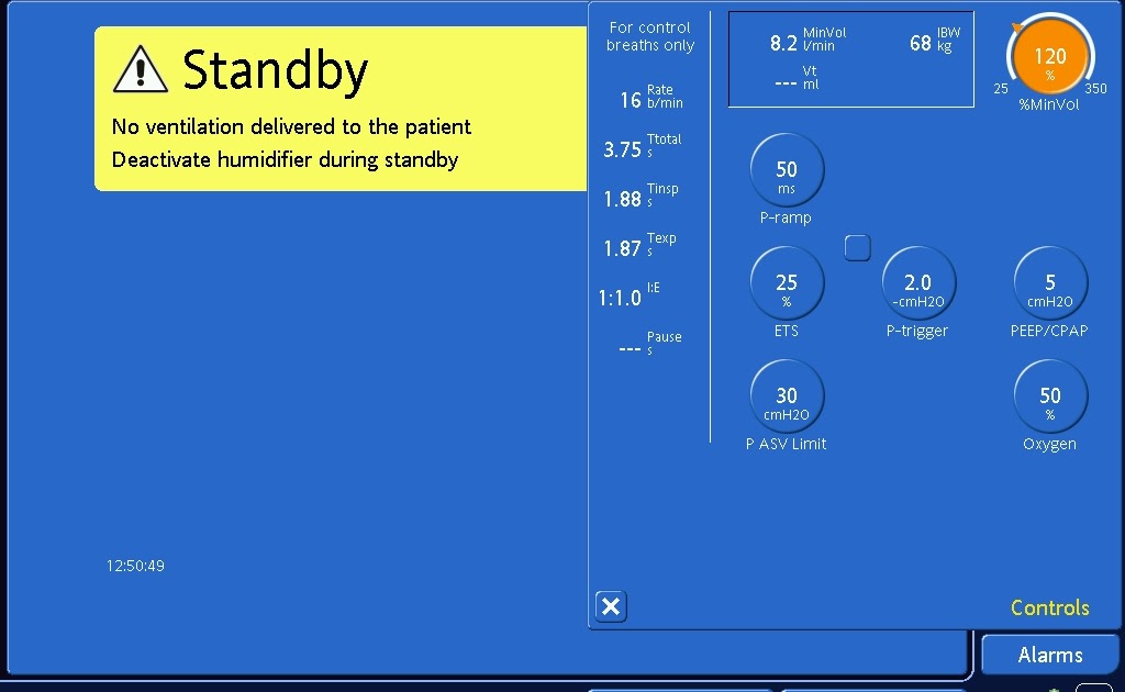 K. Scott Richey: The "ASV Target Point": Adjusting the %MinVol setting ...