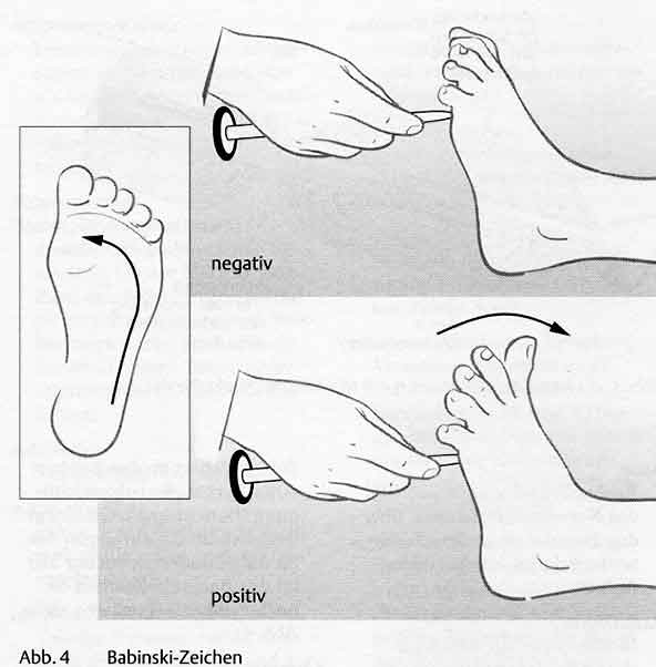 Reflejos superficiales: cutáneos y mucosos. - Ciencia Explicada