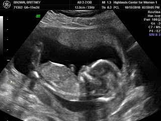 Tanner Wesley Brown 4-10-11: 15 Week Ultrasound