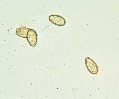 Clonorchis Sinensis Egg Slide