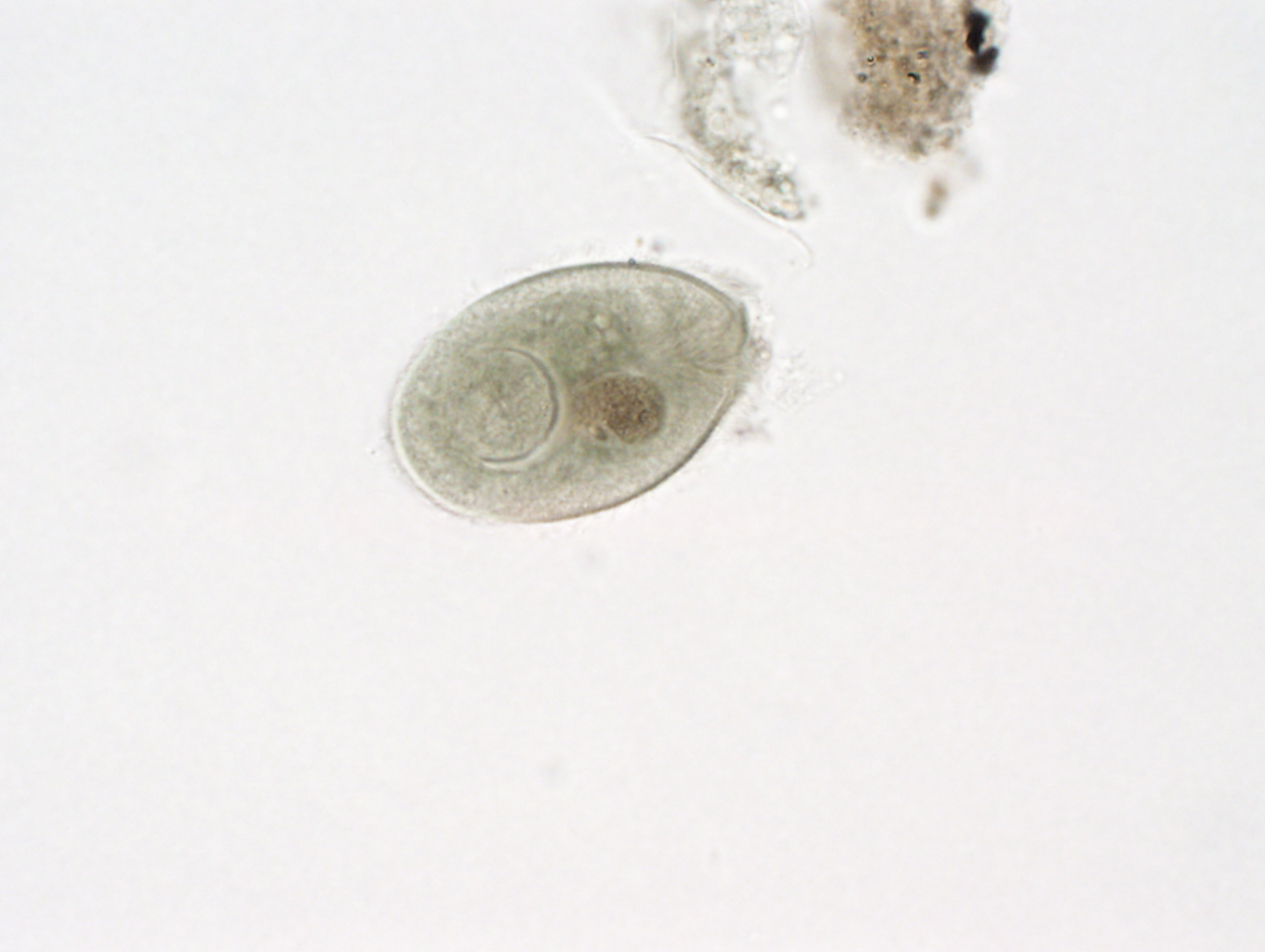 Stool Ova And Parasite