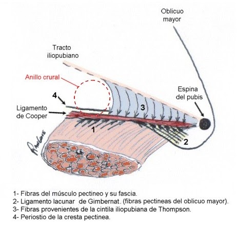 Trabajos de Investigación: REGIÓN INGUINOCRURAL: El LIGAMENTO DE COOPER ...