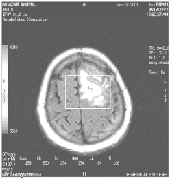 Radiologi: Magnetic Resonance Imaging (MRI)
