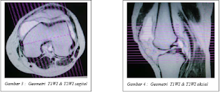Radiologi: Magnetic Resonance Imaging (MRI)