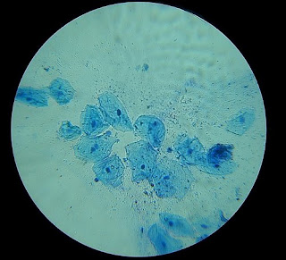 BIOLOGÍA Y GEOLOGÍA 1º BACHILLERATO IES IZPISÚA: marzo 2009