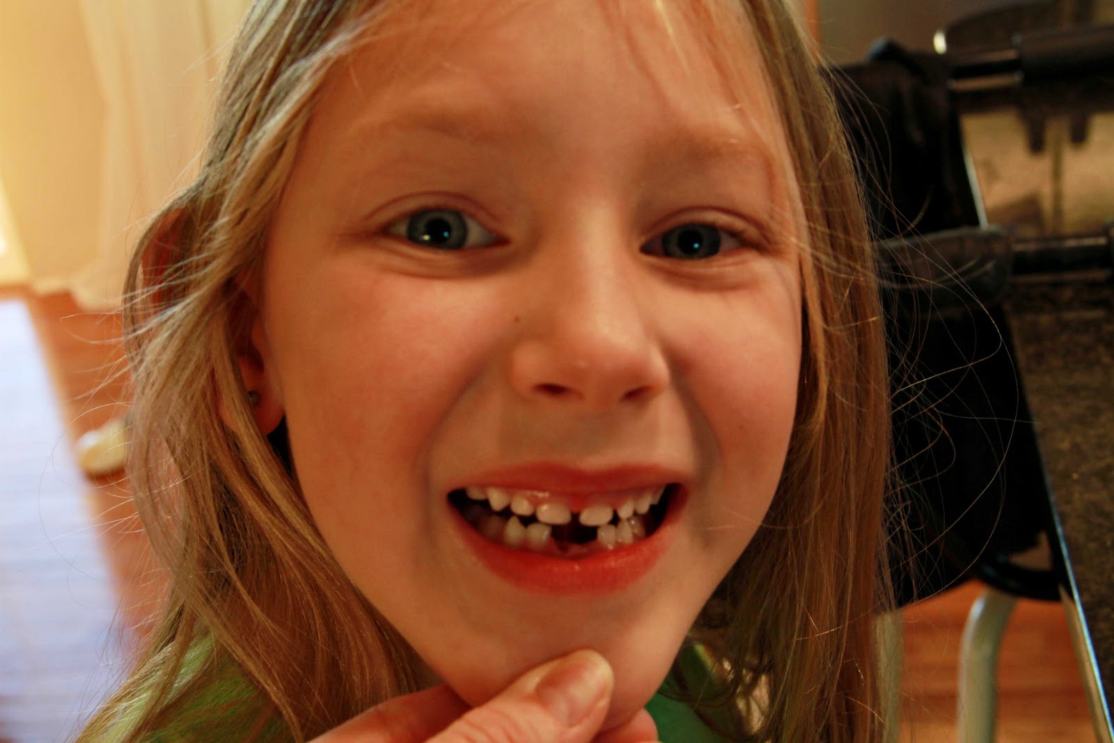 Little Mama on the Prairie: Missing Teeth....