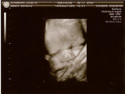 Nyla Isabella Schmieder: 35 week Ultrasound