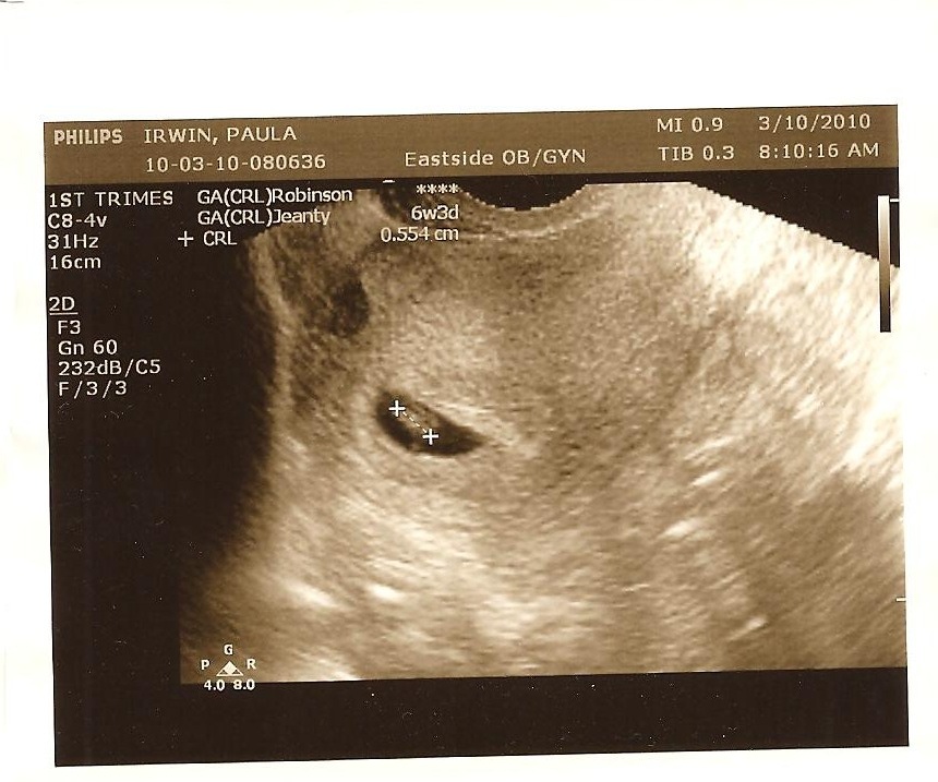 Irwin with an "I": 6 Week Ultrasounds