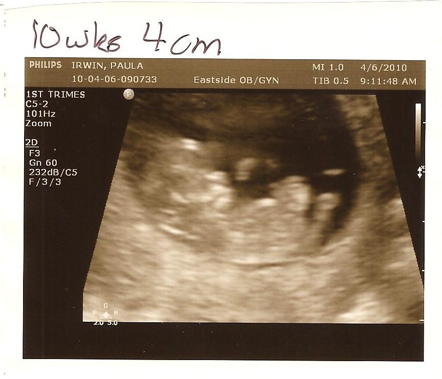 Irwin with an "I": 10 Week Ultrasound