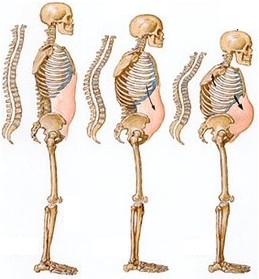 ijjjji anti aging & longevity: Posture Defeating Back Pain and Aging of ...