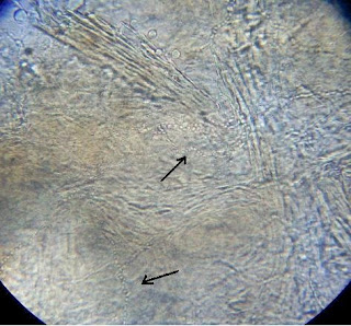 Coleção de Lâminas: Dermatofitose