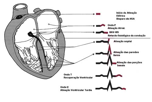 Atlas de Holter: BIGEMINISMO VENTRICULAR