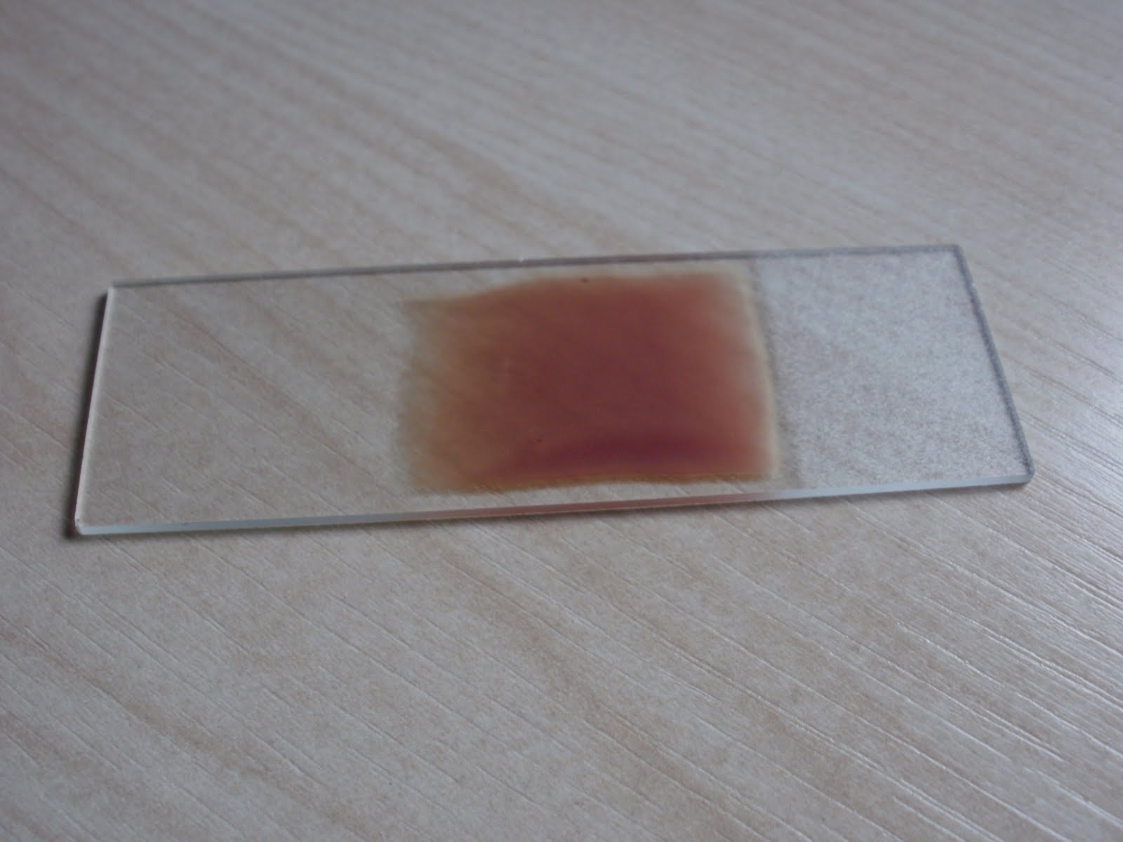 Fanos' MCB Blog: Peripheral Blood Film