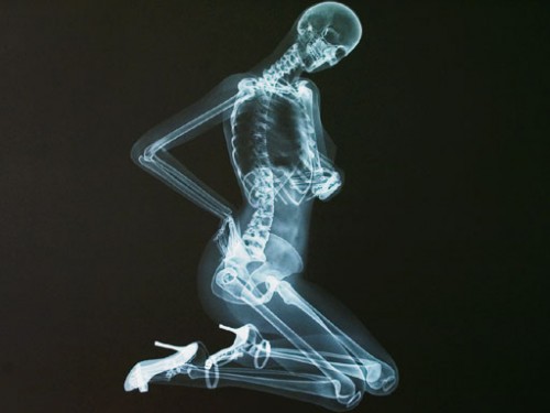 celebrities today: Most Provocative X-Rays Pinup Calendar