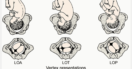NCLEX and CGFNS - MATERNITY NURSING: Fetal Presentation