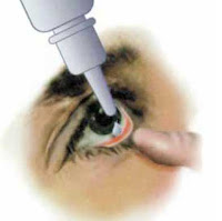Nursing Procedures: Administering Eye Drops