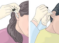 Nursing Procedures: Administering Ear Medication