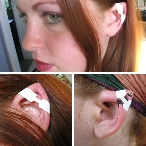 Pointy Ear Surgery