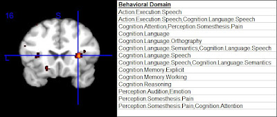 The Neurocritic: August 2008
