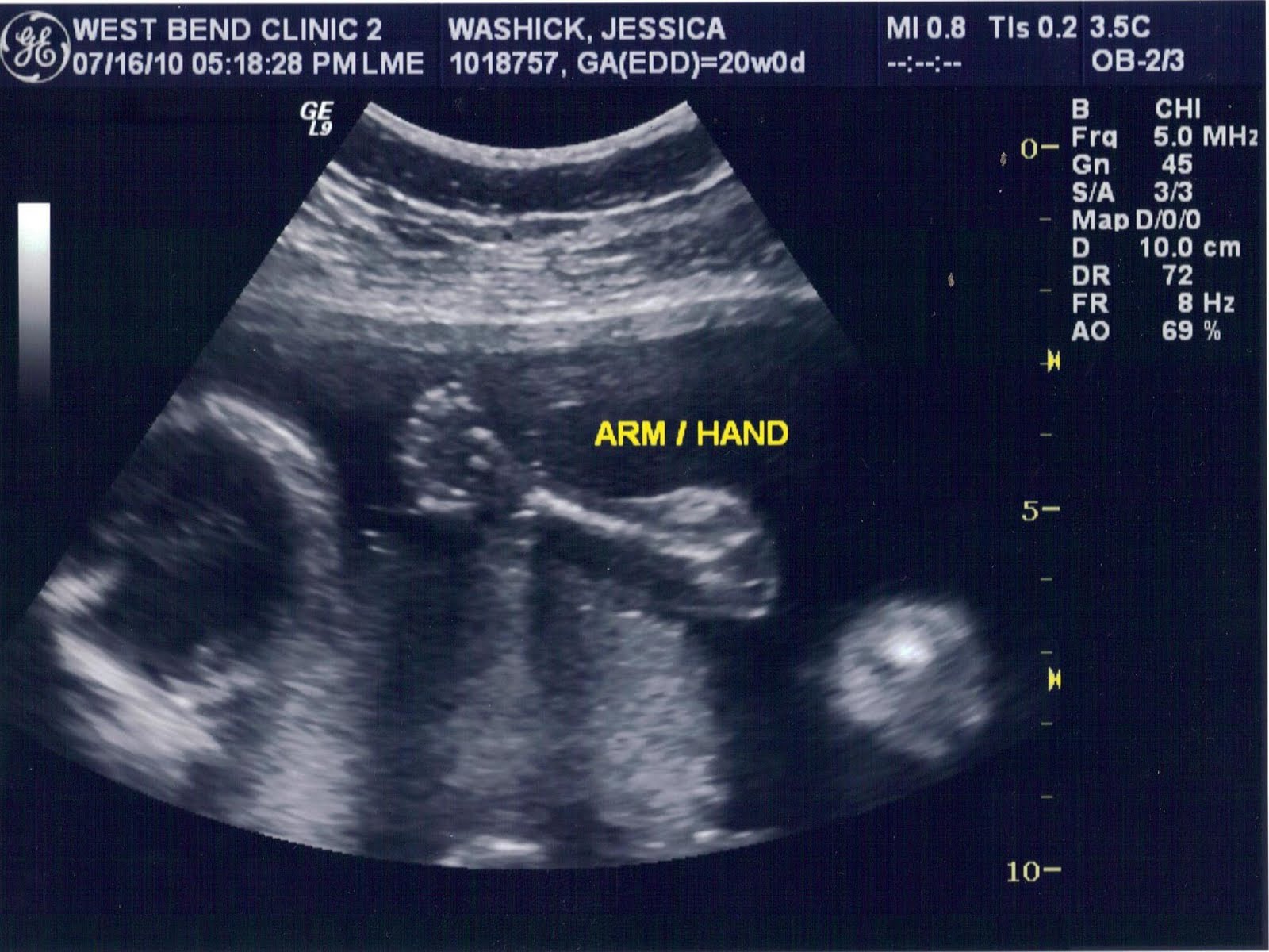 Beautiful Mess: 20 Weeks & Anatomy Scan