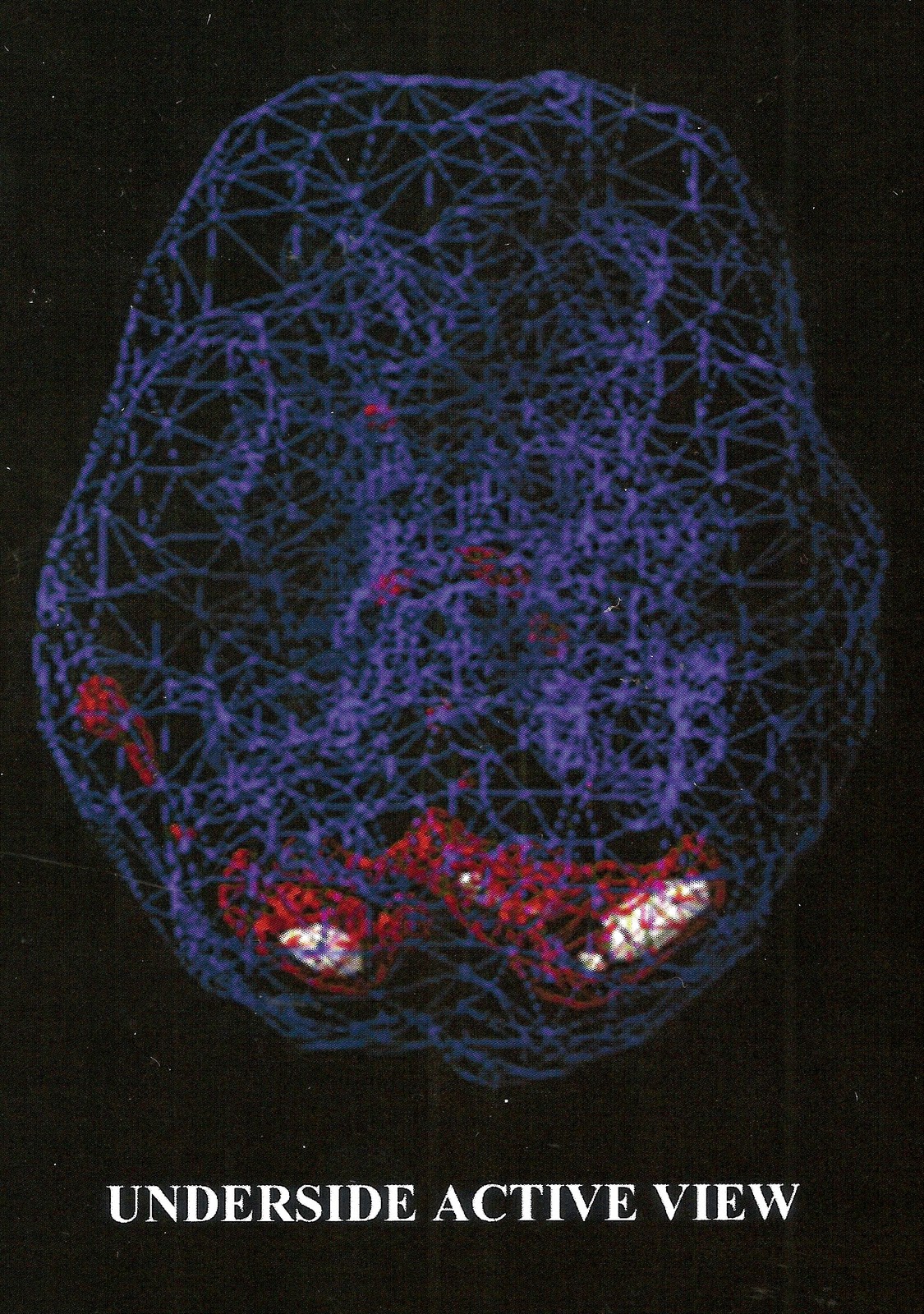 Escape from Depression: Chapter 22: Serotonin, Deep Limbic System