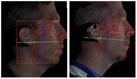 Facial Development Newsletter: THE FACE and THE AIRWAY, GENE ...