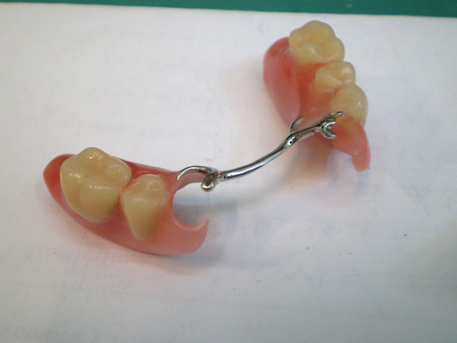 Laboratorio Génesis: Prótesis Híbrida inferior