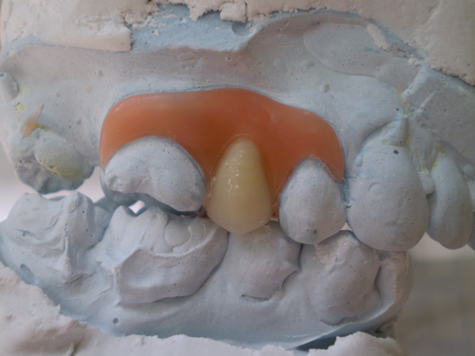 Laboratorio Génesis: Unilaterales