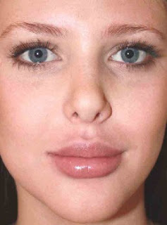 beauty is within: Crazy big lips