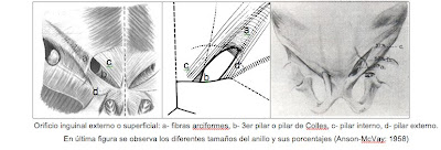 CIRUGIA MARIA CURIE: CLASE "ANATOMÍA DE LA REGIÓN INGUINAL EN EL ACCESO ...