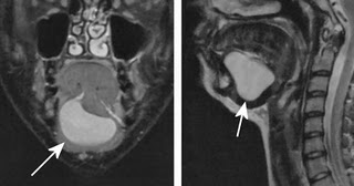 Rhoda's CT/MRI Procedures: November 2010