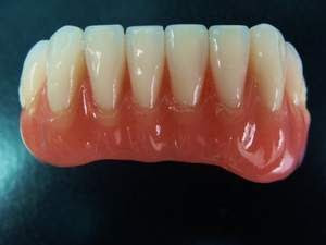 Prótesis Total 2 nivel AALD: Prótesis Total