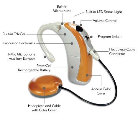 Hearing In Stereo: How Does a Cochlear Implant Work?