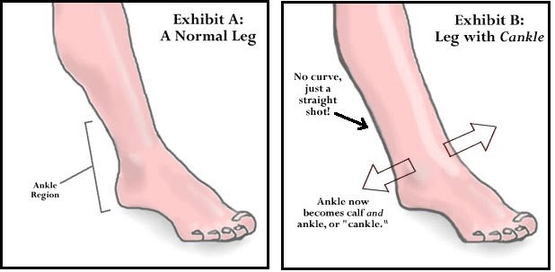 Boring Blog-O-Beth: Cankles