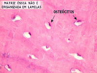 Contenido Teórico: TEJIDO ÓSEO