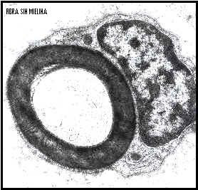 Contenido Teórico: TEJIDO NERVIOSO