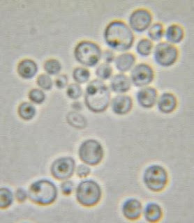BIOLOGIA MORENO: Hongos unicelulares - Levaduras (foto)